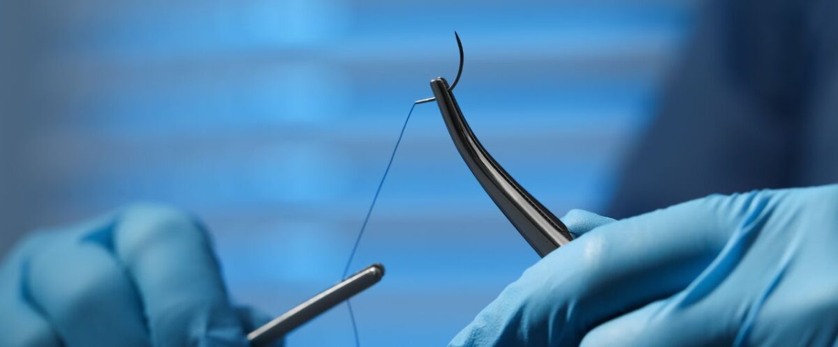 What to Do When a Surgical Incision Won’t Heal